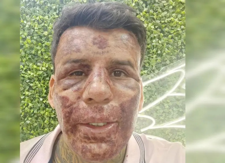 El impactante cambio de vida del hombre más tatuado de Brasil