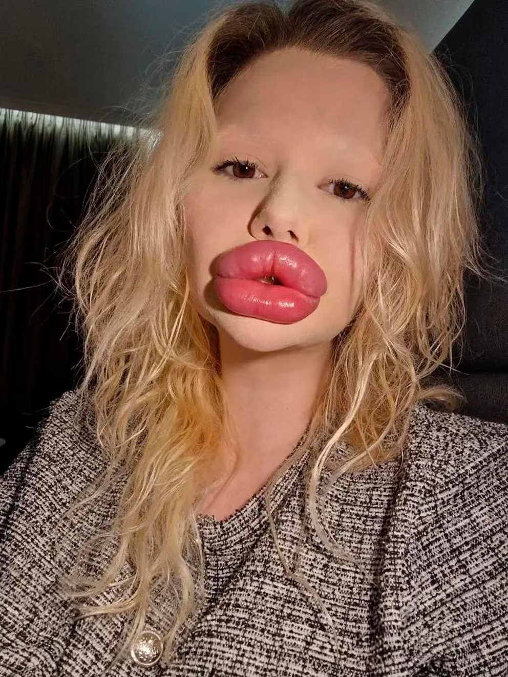 El antes y después de Andrea Ivanova, la influencer con los labios más ...