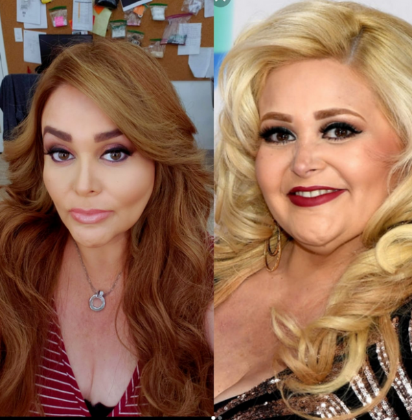 El impactante cambio de Sheyla Tadeo: donó casi 9 kilos de piel a ...